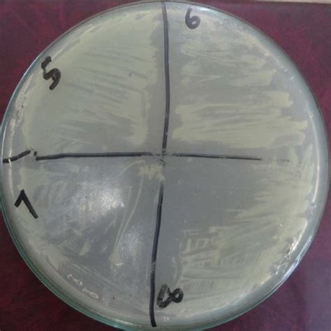 Pdf Isolation Identification And Characterization Of A Lipase Producing Pseudomonas