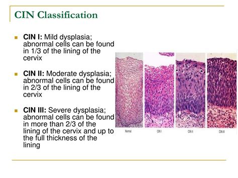 Ppt Precancer Diseases Of The Female Sexual Organs Female Cancer Powerpoint Presentation