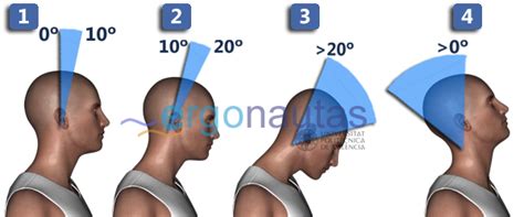 Método Rula Rapid Upper Limb Assessment Universidad Politécnica De
