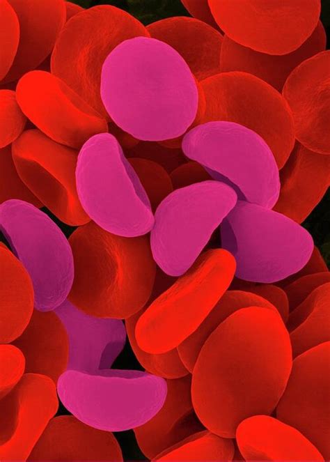 Red Blood Cells In Hypotonic Solution 2 Greeting Card By Dennis Kunkel