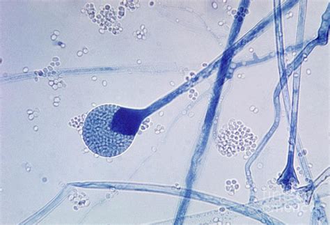 Mucor Sp Fungus Photograph By Cdc Dr Lucille K Georg Science
