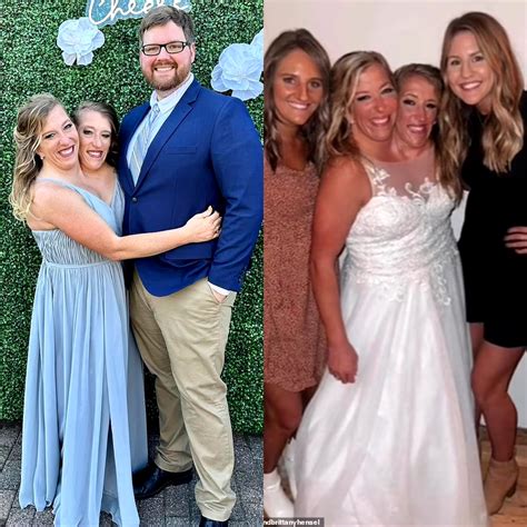 Abigail E Brittany Hensel 2024 Conjoined Twins Abby And Brittany