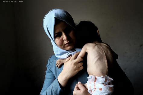 تصاویری رقت‌انگیز از شرایط بحرانی کودک سه ساله در جبالیا همشهری آنلاین