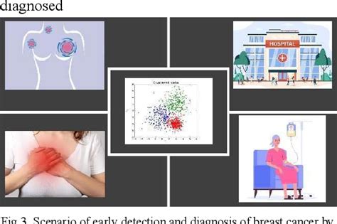 Figure 3 From Breast Cancer Prediction Using Unsupervised Learning Technique K Means Clustering