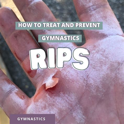 How To Treat And Prevent Gymnastics Rips A Practical Guide For Gymnas