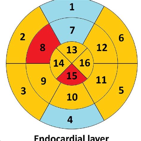 Longitudinal Strain In The Endocardial Layer For The Lad Territory Download Scientific Diagram
