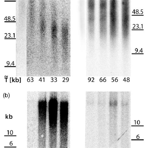 Analysis Of Terminal Restriction Fragments And Their Bal31 Sensitivity
