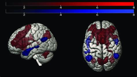 Results Of The Main Effect Of Languages Brain Areas Showing Greater Download Scientific