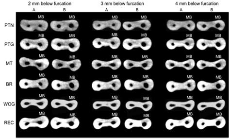Cone Beam Computed Tomography Scan Axial View Of Cervical Third Of Download Scientific
