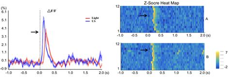 Non Invasive Hybrid Ultrasound Stimulation Of Visual Cortex In Vivo