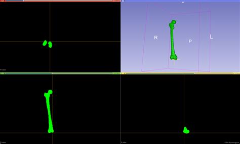 ITK 基于C 和ITK获取 D医学图像的最大连通区域 一杯清酒邀明月 博客园