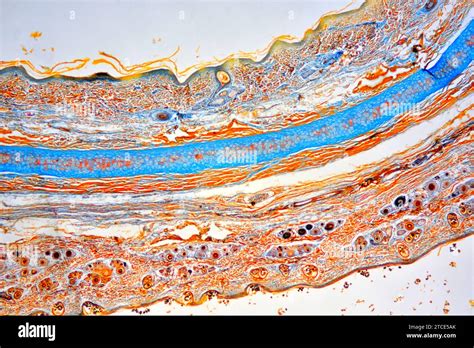 Elastic Cartilaginous Tissue From The Ear Showing Chondrocytes Elastin Fibers And Matrix