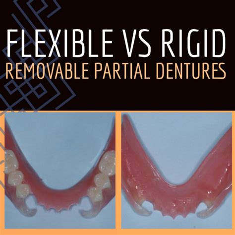 Removable Partial Dentures