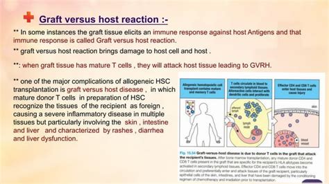 Transplantationandrejection Classification Of Graft Rejection