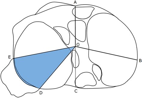 Revised Three Column Classification According To The Revised Revised Three Column Classification According To The Revised