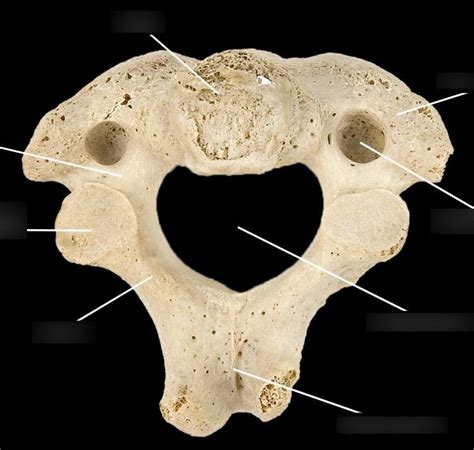 Axis C2 Inferior Diagram Quizlet