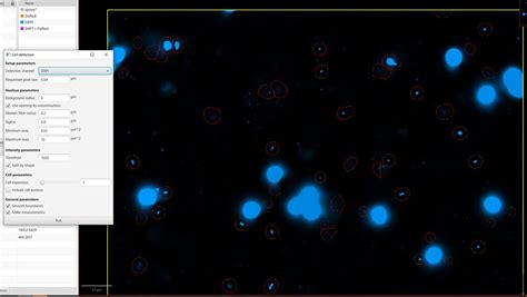 cell detection issues in qupath image analysis image sc forum