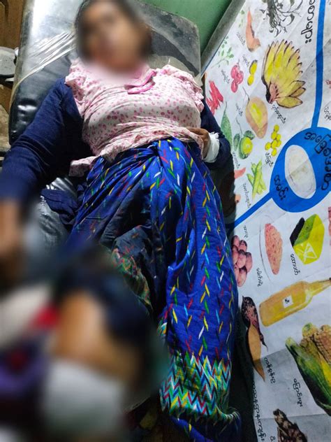 အကြမ်းဖက်စစ်ကောင်စီတပ် လက်နက်ကြီး ယမ်းကား ပစ်ခတ်မှုကြောင့် ပေါက်တော ဒေသခံ နှစ်ယောက် ဒဏ်ရာရ