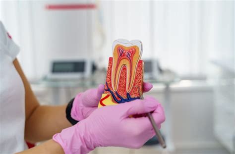 Endodontics Everything You Need To Know Chd