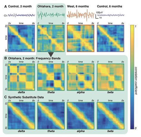 Recurrent And Persistent Motifs Of Network Correlation States Are More Download Scientific