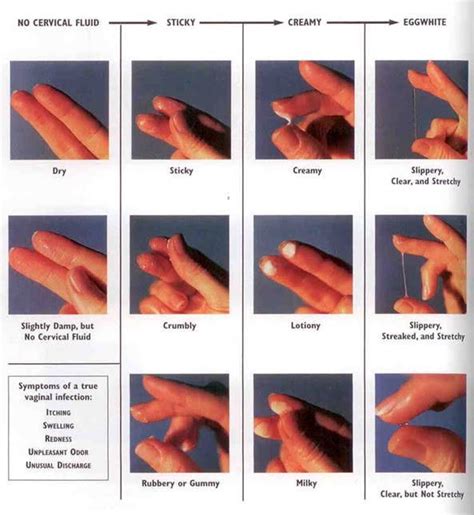 Vaginal Discharge Normal Vs Not Normal