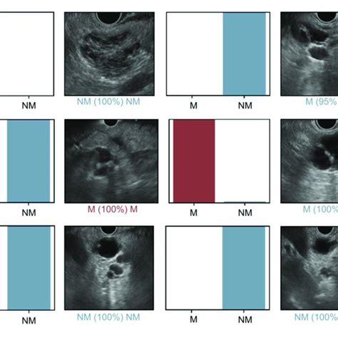 output provided during the validation phase of the convolutional neural