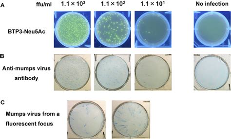 Sendai Virus Plos One