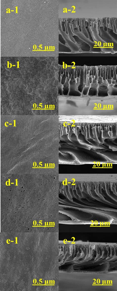 Surface Left And Cross Section Right Fesem Of Prepared Membranes A Download Scientific