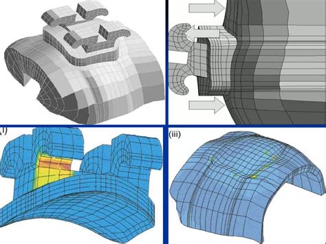 Finite Element Analysis In Orthodontics Ppt Dental Health Diseases And Conditions