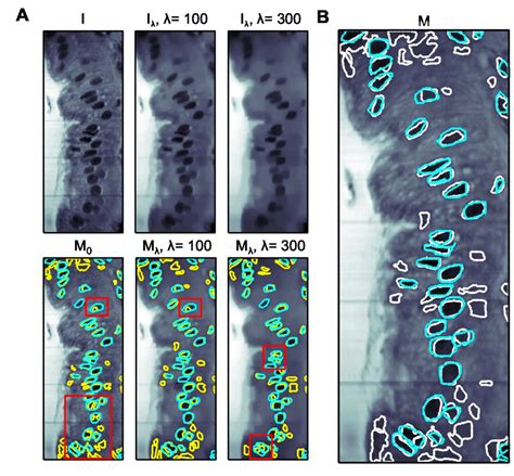 image denoising and nuclei segmentation a top row left raw image i