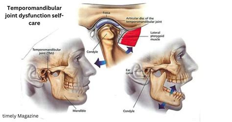 Temporomandibular Joint Dysfunction Self Care Timely Magazine