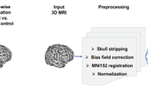 Effects Of Mri Scanner Manufacturers In Classification Tasks With Deep Learning Models