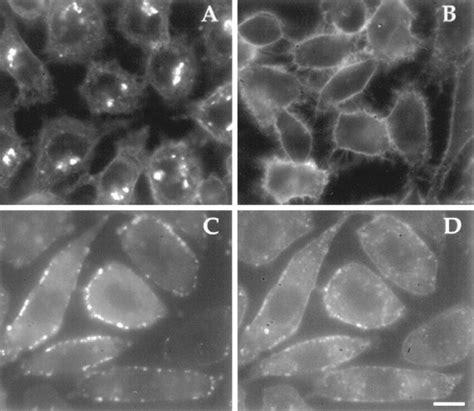 smase treatment of bodipy c12 sm labeled cells trvb 1 cells were