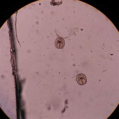 Pdf Parasite Helminthes Class Cestode Diagnosed By Hooklets On Fnac