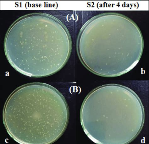 Plate Count Agar Media Showing Colony Forming Units Total Bacterial Download Scientific