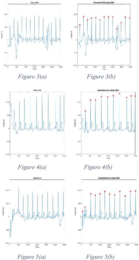 Deep Learning Assisted Tool For Atrial Fibrillation Detection Using RR Intervals Semantic Scholar