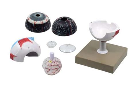 Eisco Upper Triple Root Molar With Caries Model Enlarged 15 Times 2