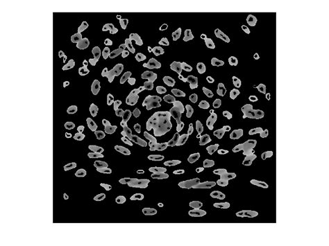 Basic Cell Counting And Segmentation In Matlab