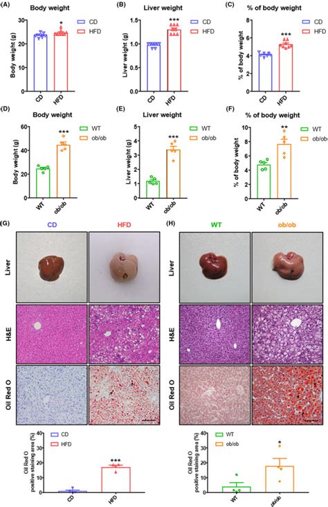 Hepatic Transcriptome Signatures In Mice And Humans With Nonalcoholic