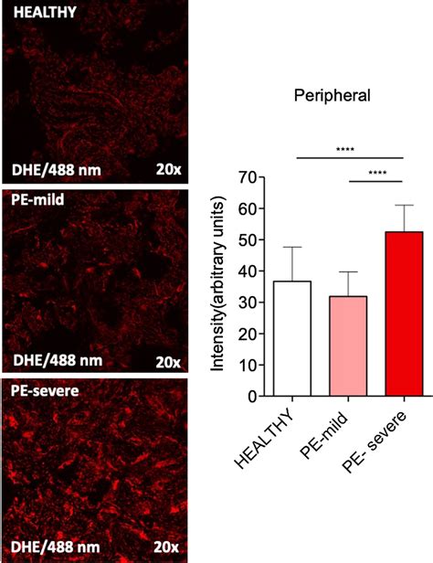 Assessment Of Placental Oxidative Stress Dhe Staining In Peripheral Download Scientific