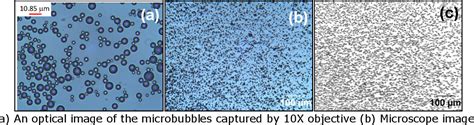 Figure 1 From Effect Of Temperature On Stability Of Lipid Microbubbles
