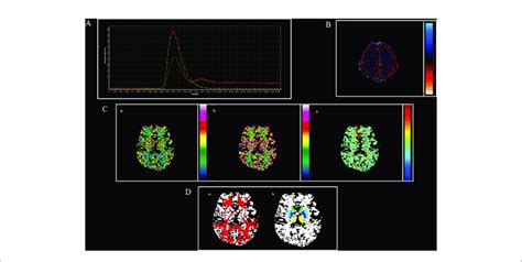 Dsc Perfusion Maps And Their Overlap With Structural Masks In An Ms