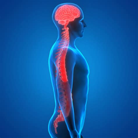 Neurogenic Bladder Dysfunction Wellspect