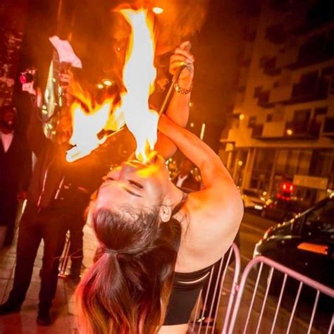 Love Island Sophie Lee fire accident which scarred her face - 'I couldn ...