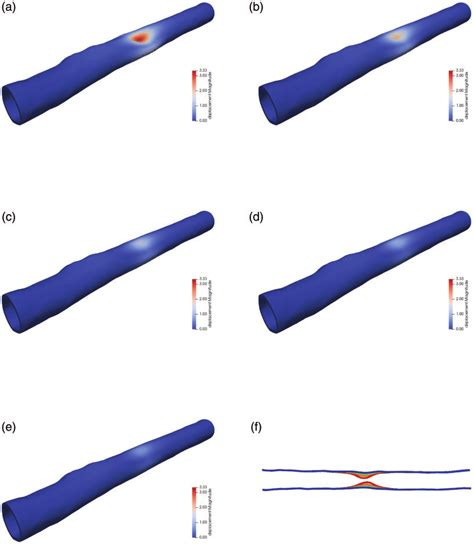 A E Vessel Squeezing For Different Choices Of Youngs Modulus F Download Scientific