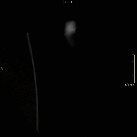 Ct Wrist Contrast And Non Con Rad Ct Guide