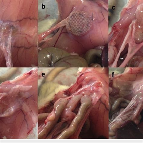 Macroscopic Evaluation Of Peritoneal Adhesion Degrees After