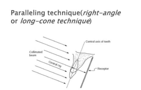 Radiology Chapter 19 Paralleling Technique Flashcards Quizlet
