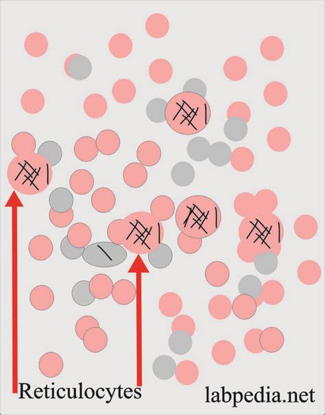 Reticulocyte Count Retic Count And Interpretations