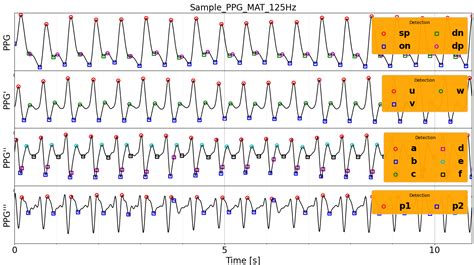 Comprehensive Ppg Analysis — Pyppg 100 Documentation
